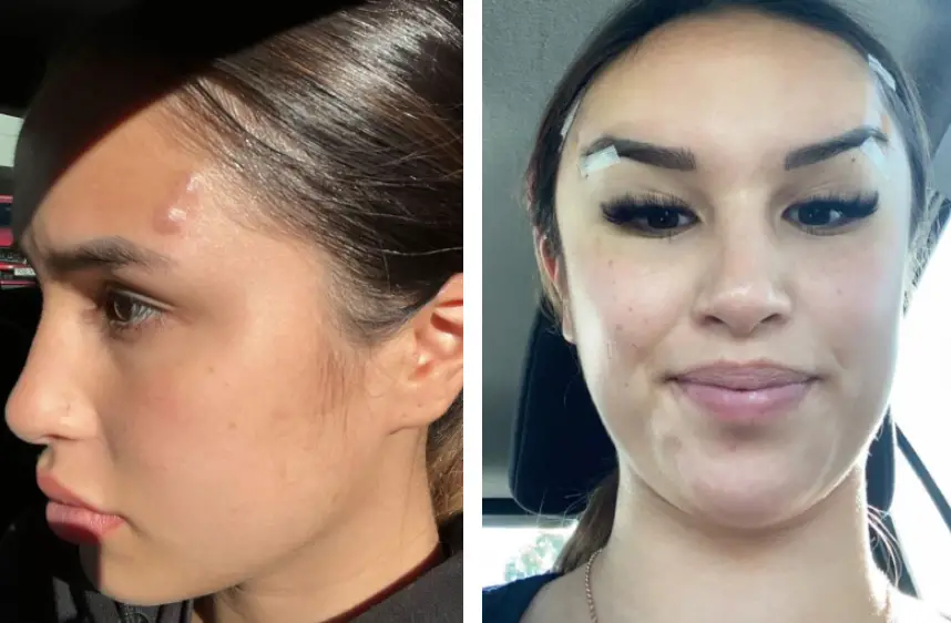 Model Left with ‘Misshapen Eyes’ and ‘Horn-Like Protrusions’ From ...