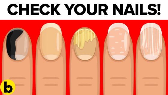 What Your Nails Say About Your Health (Look at your nails to see what ...